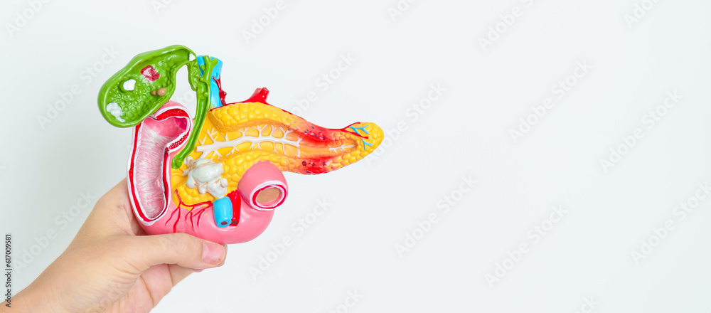Doctor with human Pancreatitis anatomy model with Pancreas, Gallbladder ...