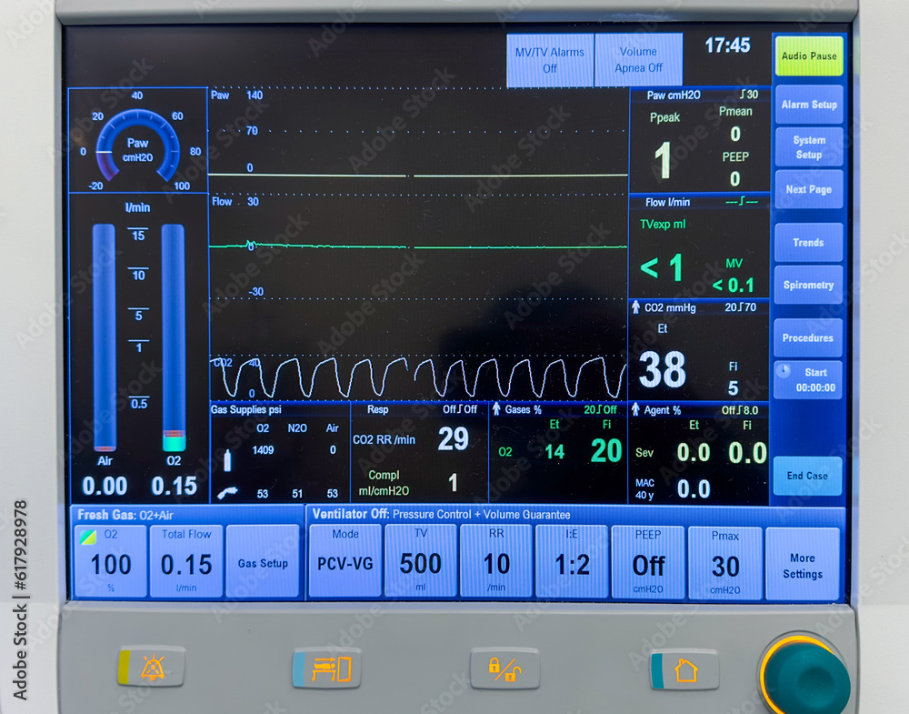 Medical vital signs monitor displaying critical health metrics - blood ...
