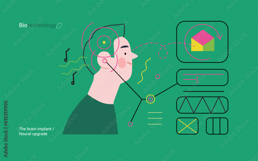 Bio Technology, Brain implant, Neural upgrade -modern flat vector concept illustration of brain ...