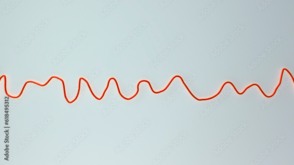 Electrocardiogram ECG displaying ventricular fibrillation rhythm, 3D ...