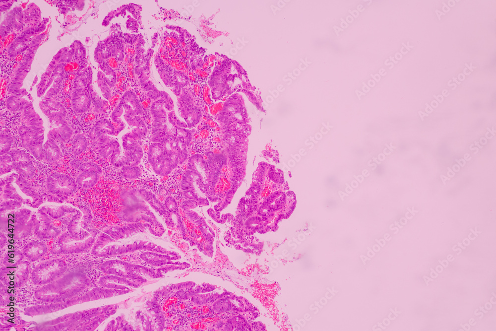 Backgrounds of human cells tissue of lung human under the microscope in ...