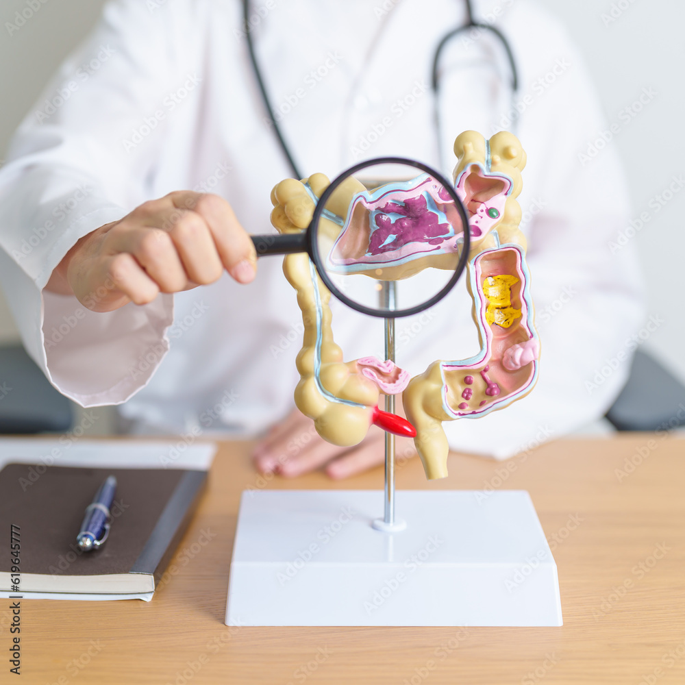 Doctor with human Colon anatomy model and magnifying glass. Colonic ...