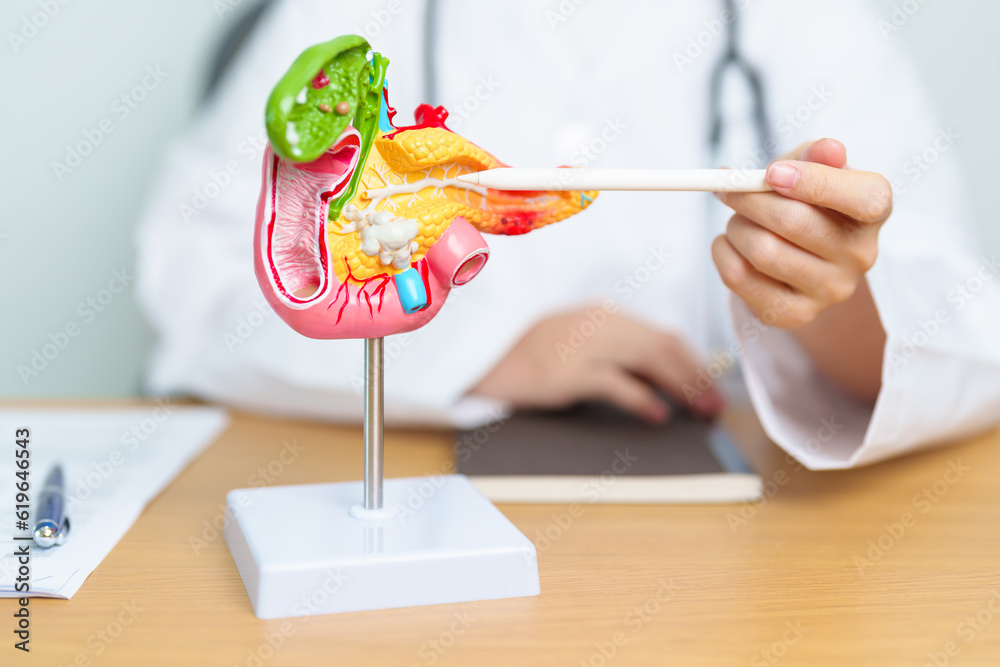 Doctor with human Pancreatitis anatomy model with Pancreas, Gallbladder ...