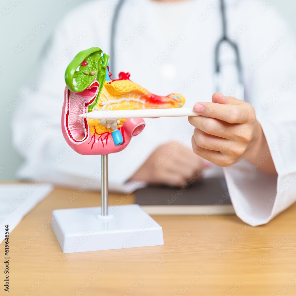Doctor with human Pancreatitis anatomy model with Pancreas, Gallbladder ...