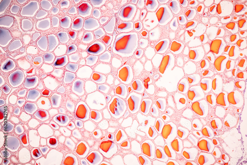 Showing Light micrograph of the Thyroid gland and Thymus gland human ...
