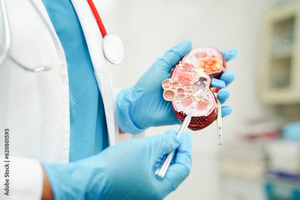 Chronic kidney disease, doctor holding model for treatment urinary ...