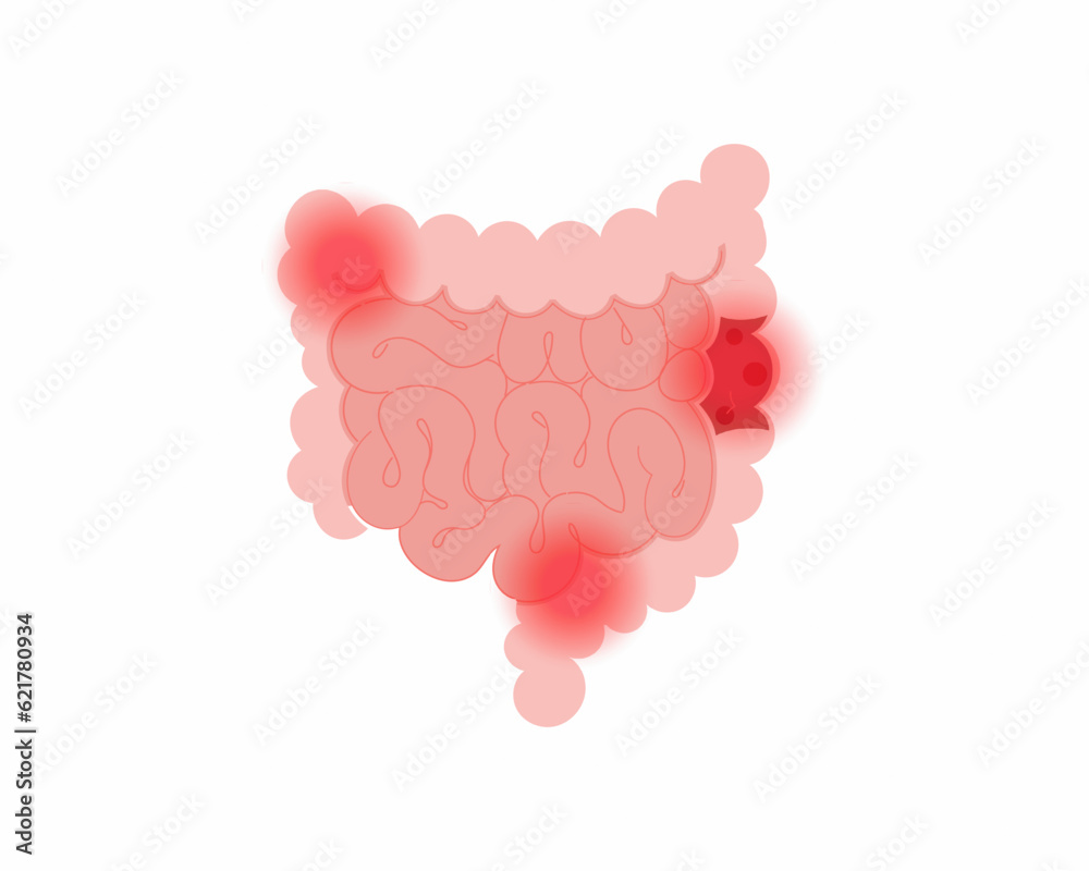 Abdominal pain and colon problem in human body Human intestines anatomy ...