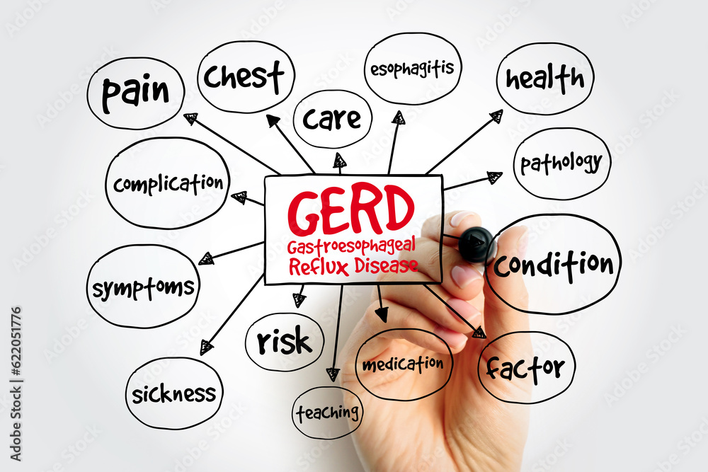 GERD - Gastroesophageal Reflux Disease mind map, medical concept for ...