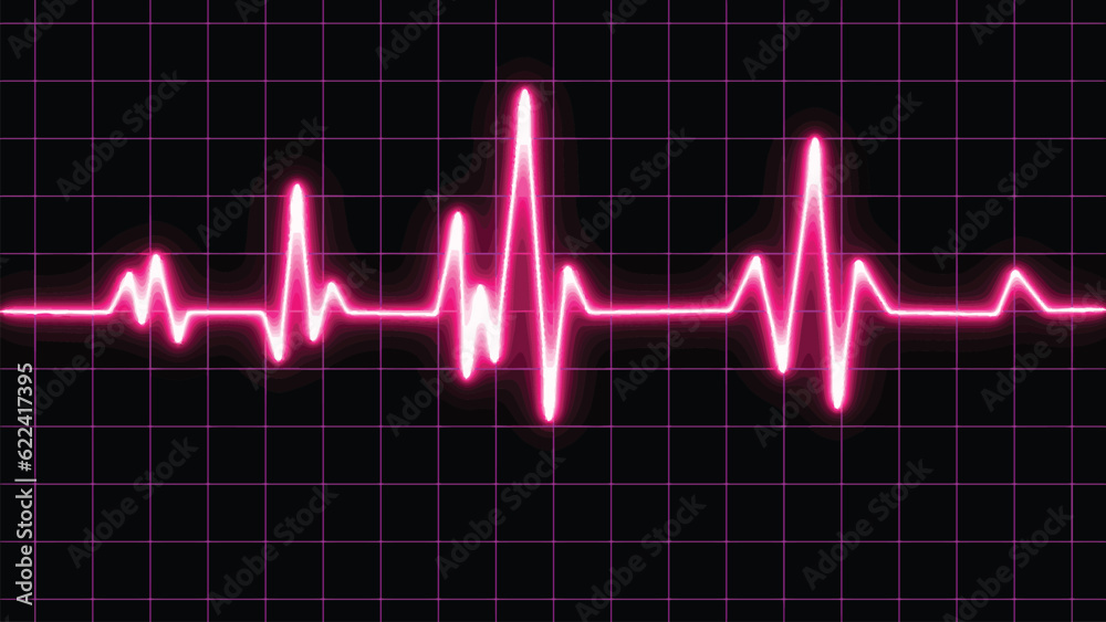 Vetor Heart rate graphics. Electrocardiogram. Vector illustration ...