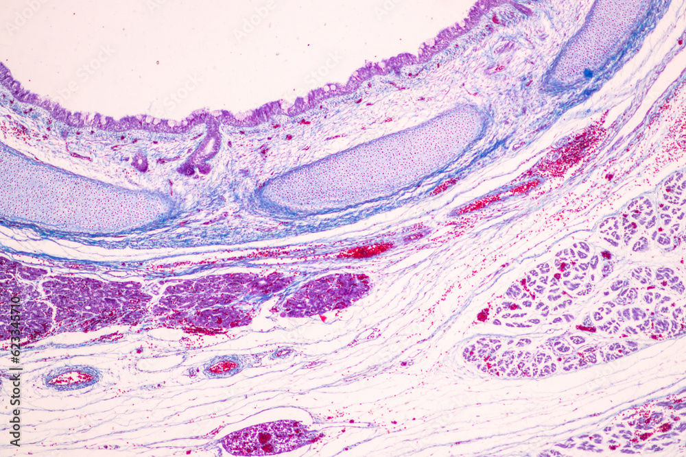Showing Light micrograph of the Trachea, Thymus, Parathyroid gland and ...