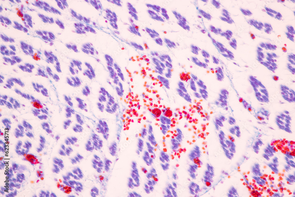 Showing Light micrograph of the Trachea, Thymus, Parathyroid gland and ...