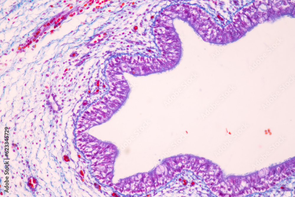 Showing Light micrograph of the Trachea, Thymus, Parathyroid gland and ...