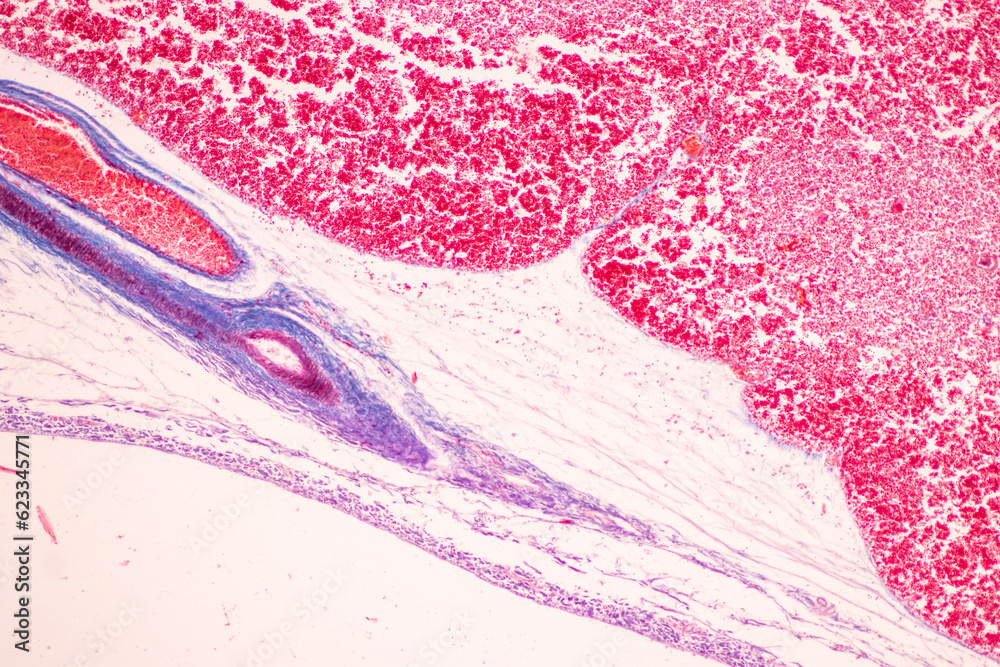 Showing Light micrograph of the Trachea, Thymus, Parathyroid gland and ...