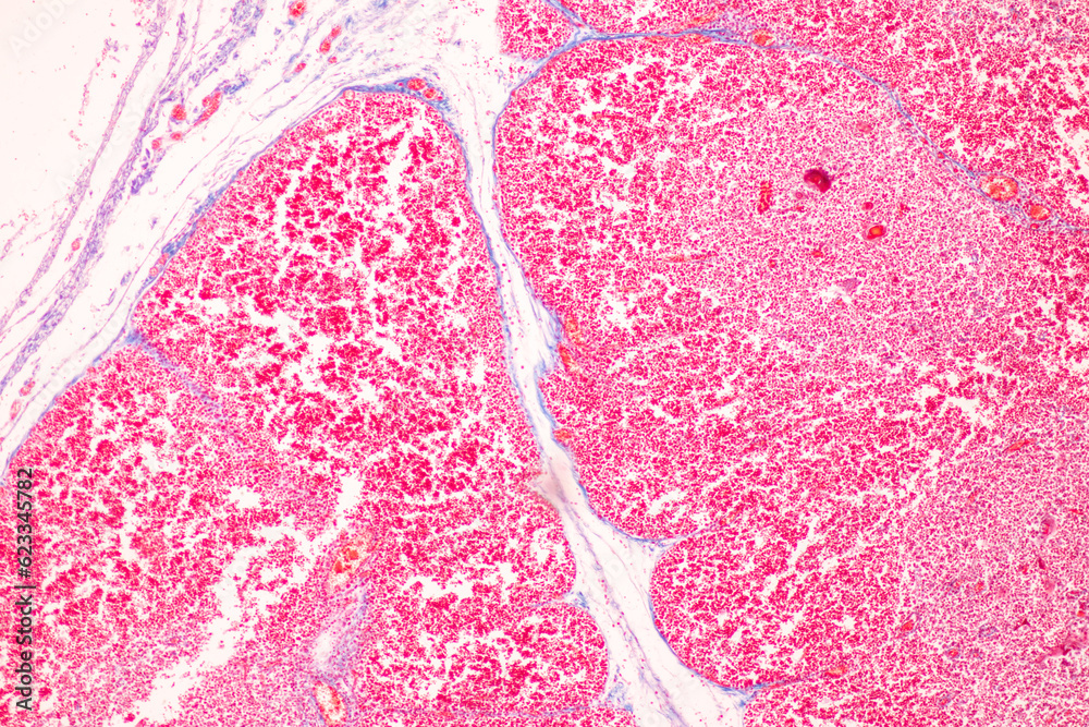 Showing Light micrograph of the Trachea, Thymus, Parathyroid gland and ...