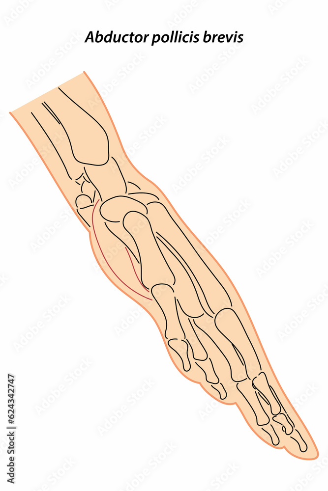 Medical illustration of Abductor pollicis brevis hands muscle. Line ...