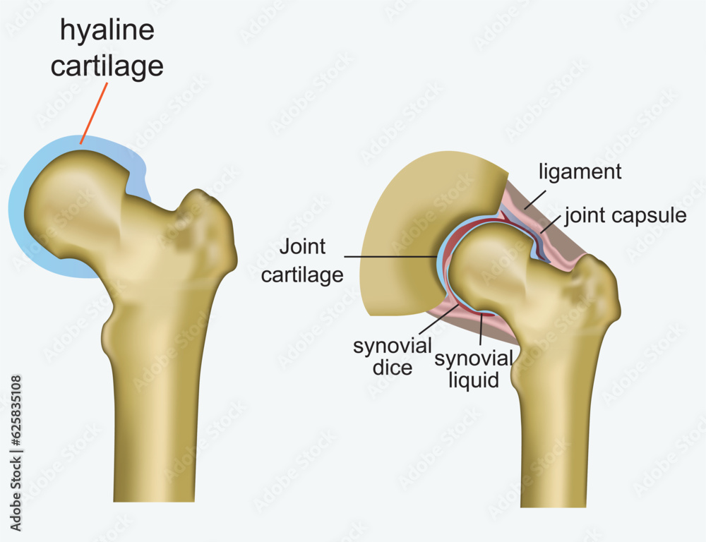 Stages of knee osteoarthritis. From Minimum disruption to lost a ...