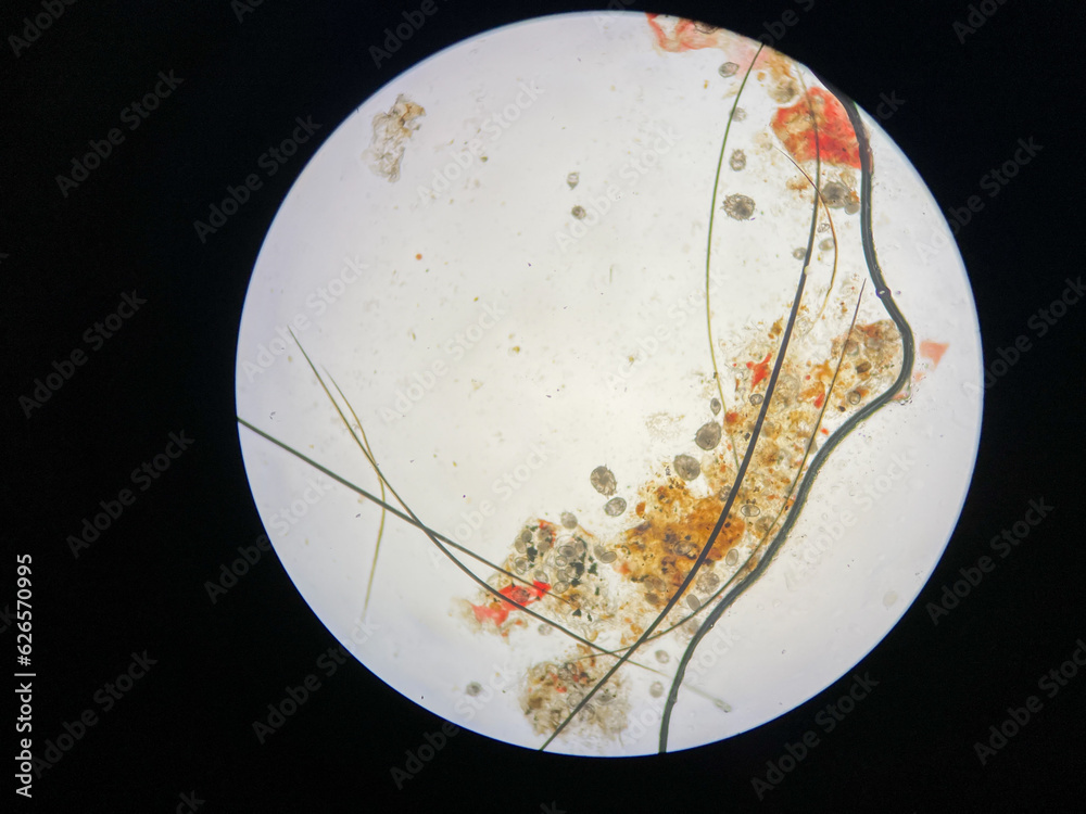 Notoedres cati under the microscope. Notoedric mange, also referred to ...