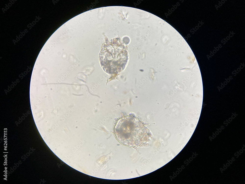 Notoedres cati under the microscope. Notoedric mange, also referred to ...