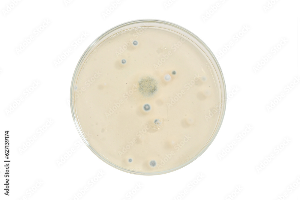 Colony morphology of Yeast and mould. Fungal colony morphology. Fungal ...
