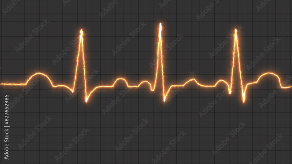 Human heart normal sinus rhythm electrocardiogram. ECG. EKG. Vital sign ...