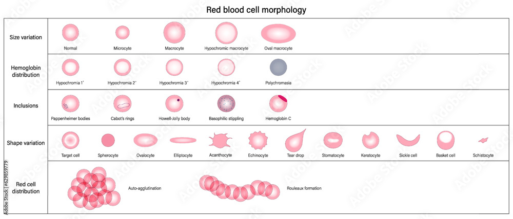 Red blood cell morphology. Size variation, Hemoglobin distribution ...