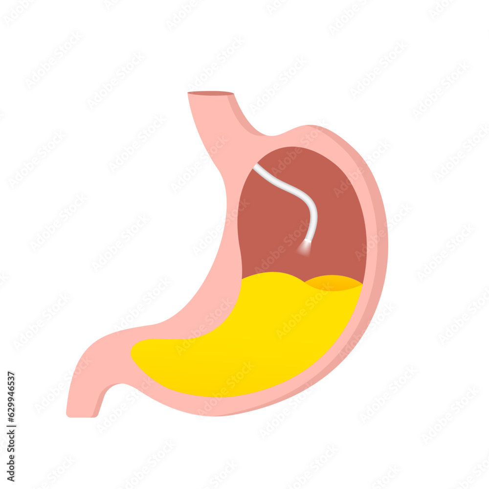 Vetor Stomach ache pain icon, endoscope gastroscopy examination ...