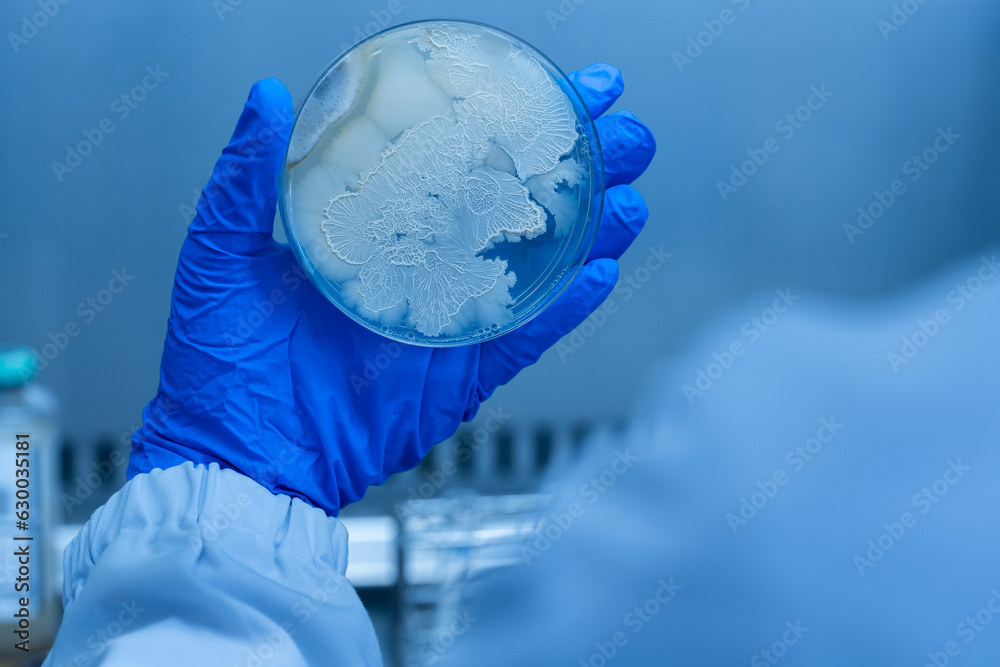 Scientist hand wearing blue gloves hold agar plate for diagnosis ...