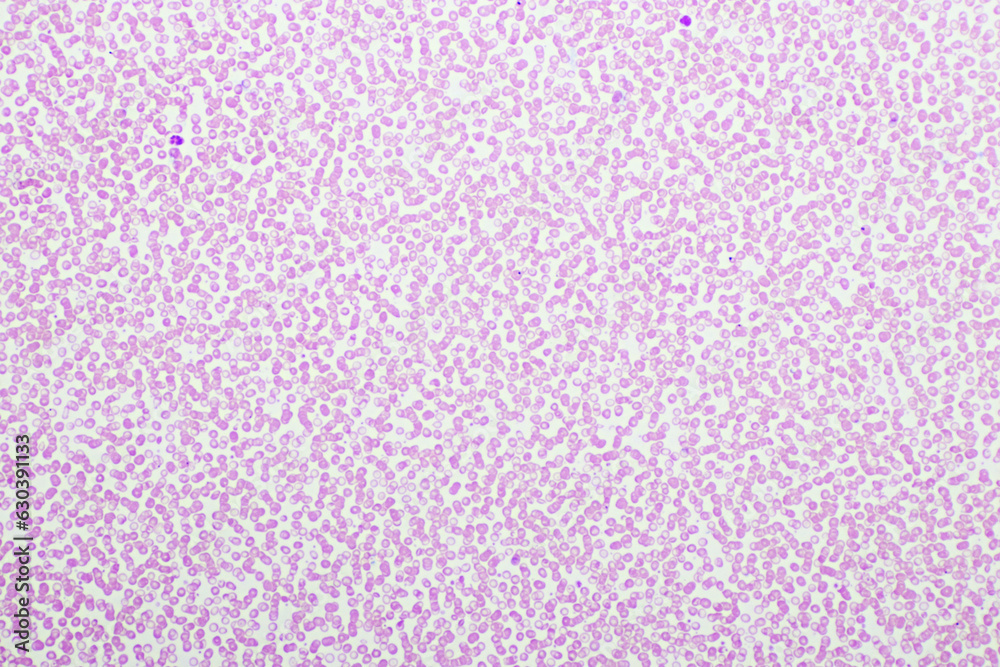 Foto de Stock Red blood cells and white blood cells in blood smear ...