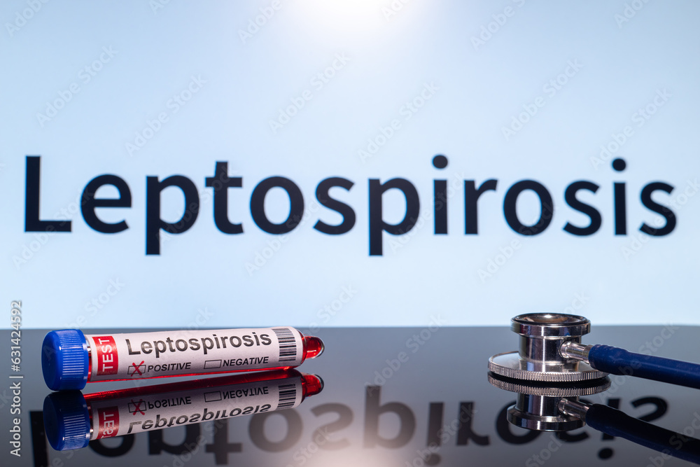 Blood collection tubes Leptospirosis test positive results ...