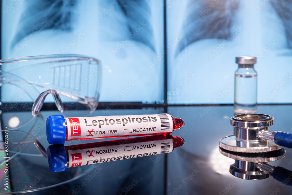 Blood collection tubes Leptospirosis test positive results ...
