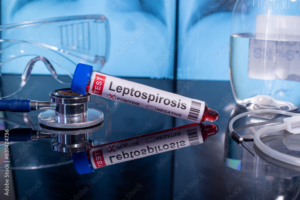 Foto de Stock Blood collection tubes Leptospirosis test positive ...