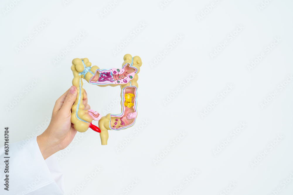 Doctor with human Colon anatomy model. Colonic disease, Large Intestine ...