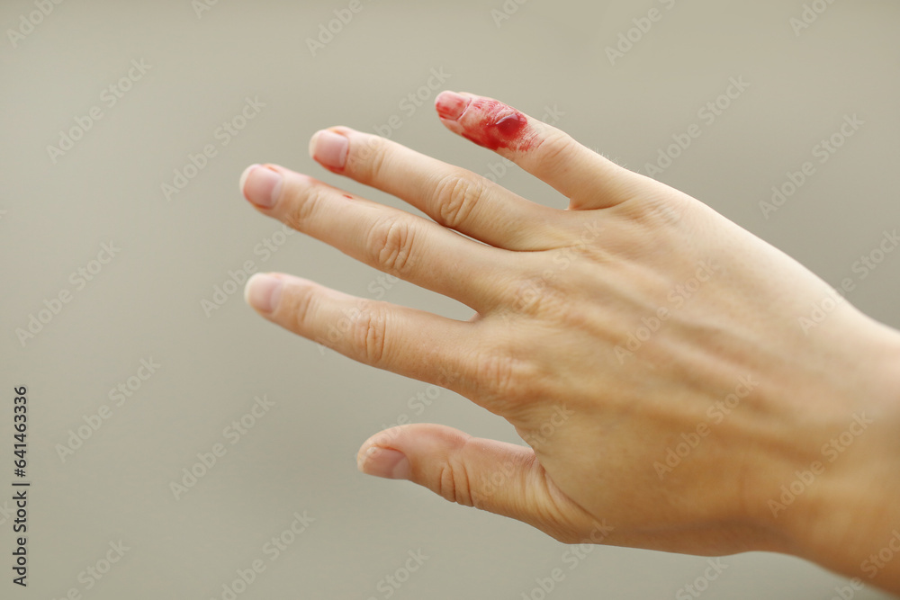 Female hand with red blood, little finger is bleeding profusely. Woman ...
