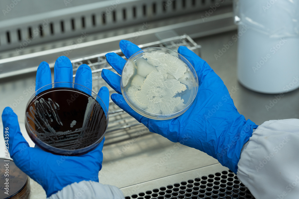 Scientist hand wearing blue gloves hold agar plate for diagnosis ...