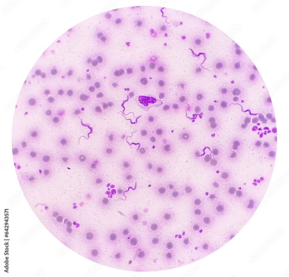 Trypanosoma sp. among red blood cells. Trypanosome species in blood ...