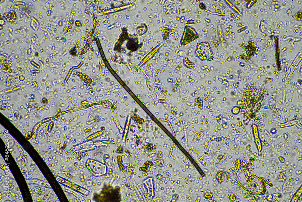 Fungal and fungi hyphae under the microscope in the soil and compost ...