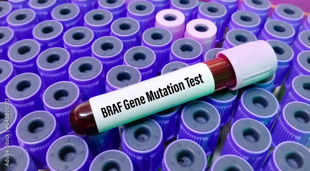 BRAF genetic test to detect the change of tumor that are present in ...