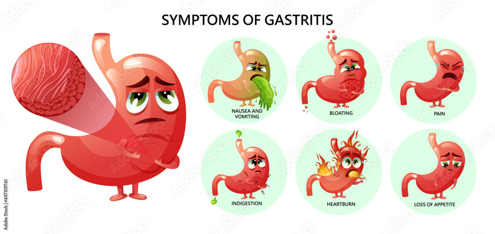 Cartoon stomach characters infographic gastritis symptoms Stock Vector ...