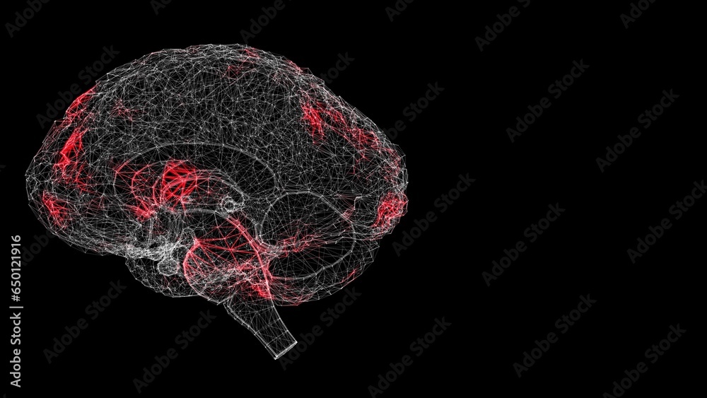 Spread of virus through 3D human brain on black background. Visual ...