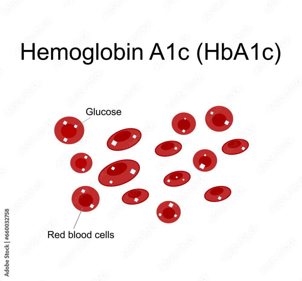 Vector de Stock The picture represents a diagram of Hemoglobin A1c ...