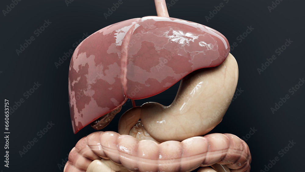 Digestive Organ Liver Cancer, Hepatitis cirrhosis malignant tumor ...