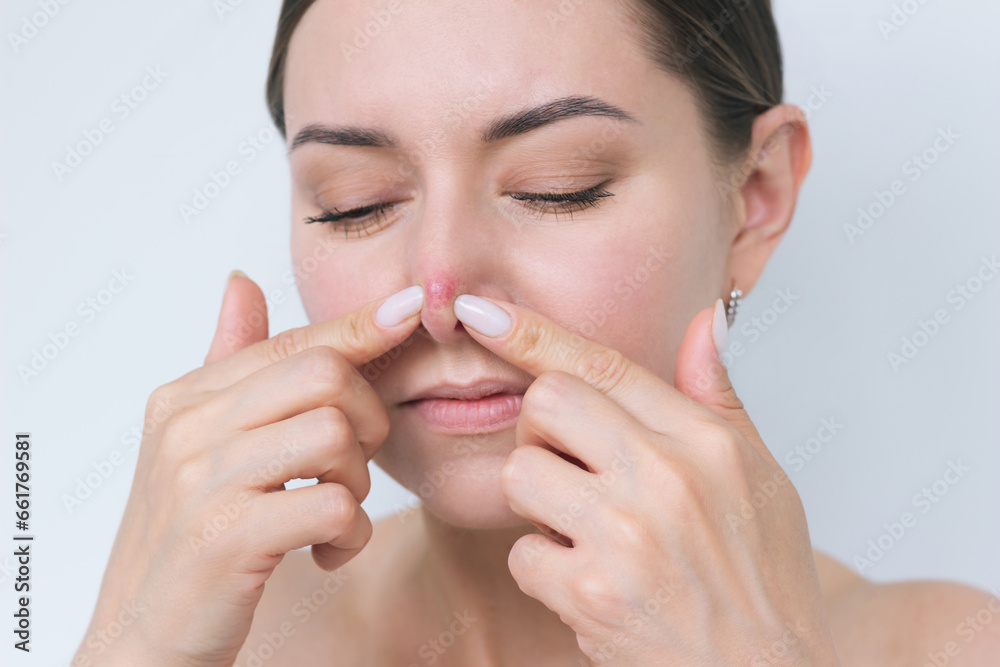 a close-up photo of the face of a young dark-haired woman squeezing out ...