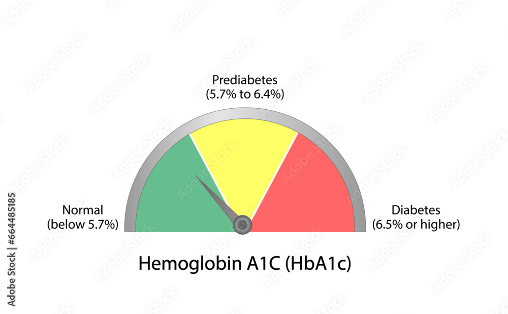 Hemoglobin A1C, HbA1c test , HbA1c levels, Glucose sticks to hemoglobin ...