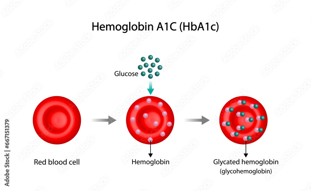 Hemoglobin A1C, HbA1c test , HbA1c levels, Glucose sticks to hemoglobin ...