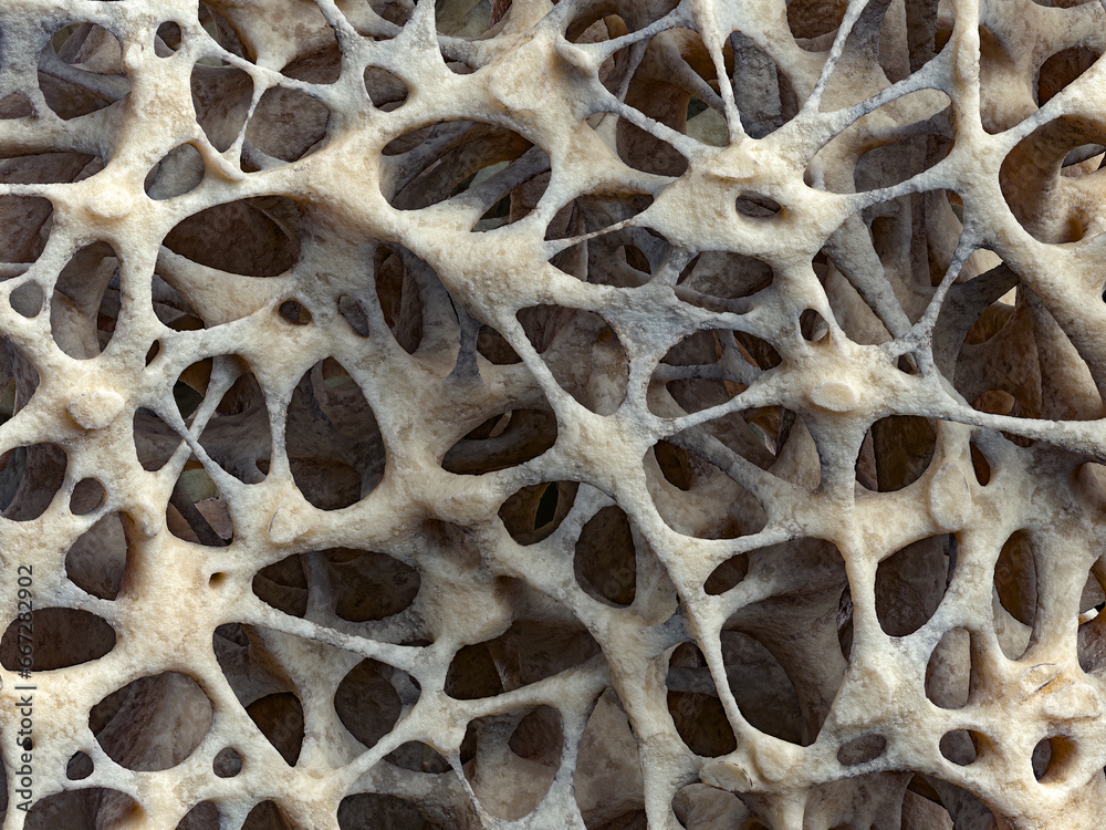 Realistic bone spongy structure close-up, bone texture affected by ...