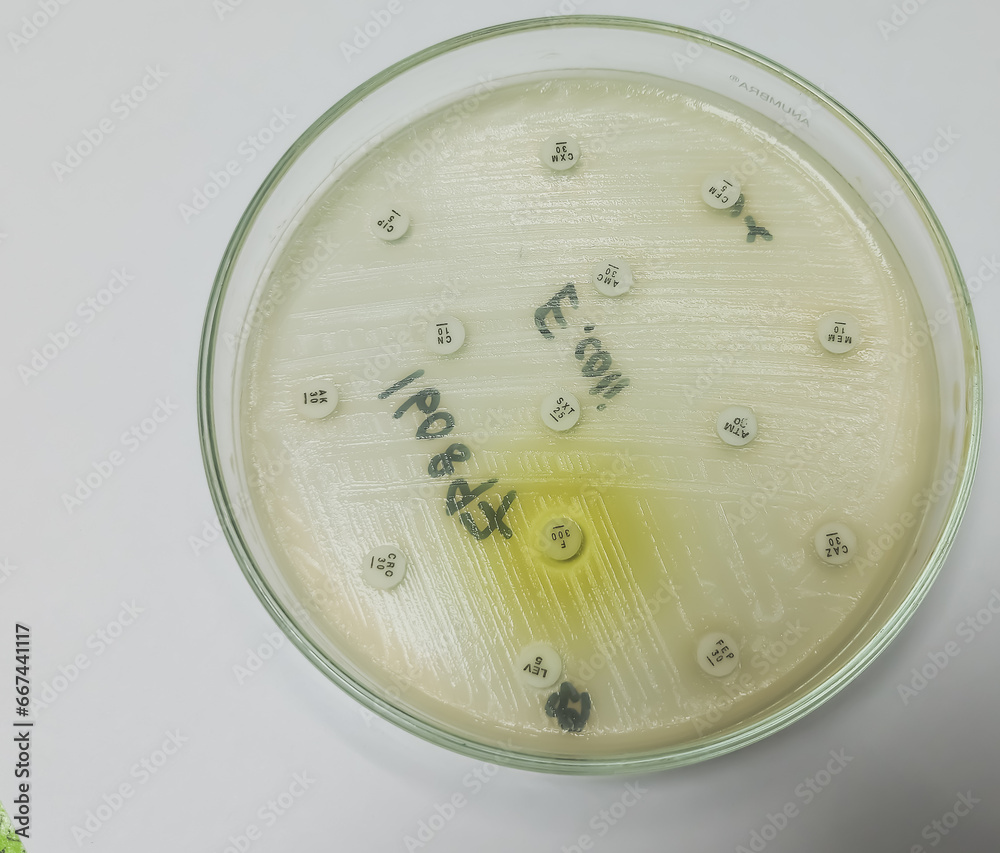 All antibiotic are resistance. Antimicrobial susceptibility testing in ...
