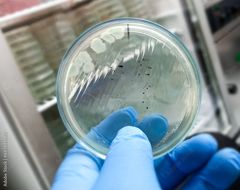 Culture of Penicillium spp. fungus on Sabouraud Dextrose Agar (SDA ...