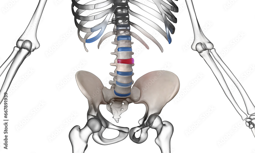 Bulging disc spinal injury skeleton medical illustration Stock ...