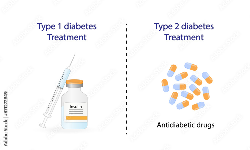 Insulin and antidiabetic drugs. Diabetes mellitus type 1, pancreas's ...