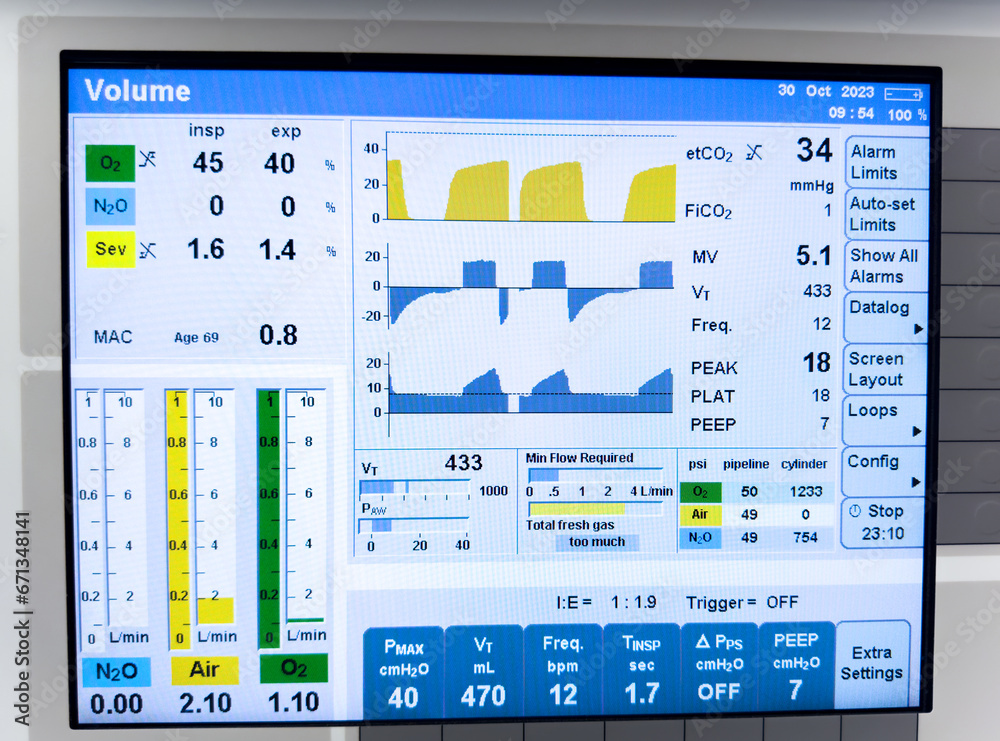 hospital monitor displaying vital signs: blood pressure, heart rate ...